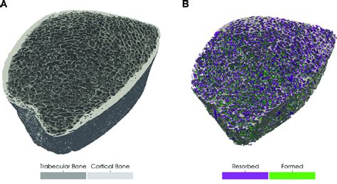 a three dimensional image of the distal tibia depicting trabecular