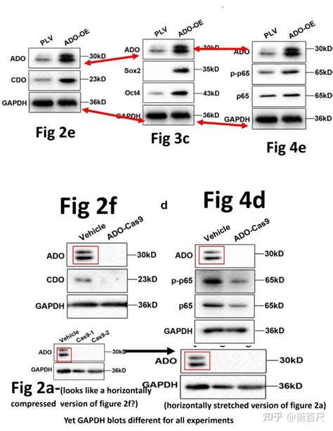 中外合作造假？大连附属中山医院的一篇论文在pubpeer被热烈讨论 知乎