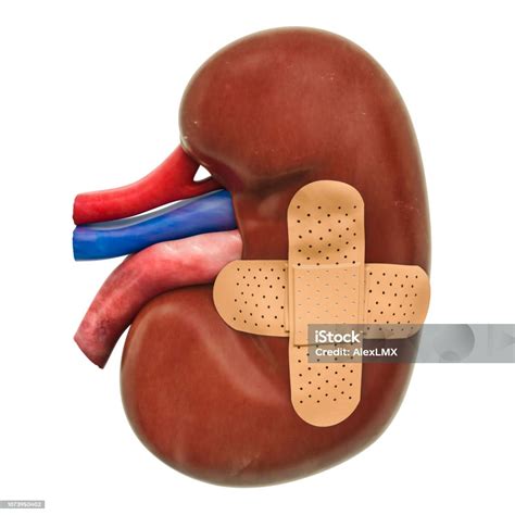 접착 붕대와 인간 신장입니다 3d 렌더링에 고립 된 흰색 배경 신장 개념의 치료 콩팥 내부 기관에 대한 스톡 사진 및 기타