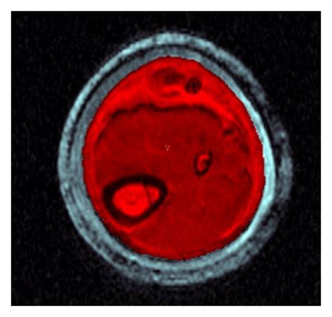 Semiautomatic Segmentation Of The Surface Area Of Test Specimen Download Scientific Diagram