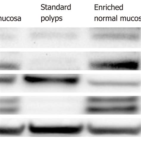 Representative Western Blotting Showing Estrogen Receptor Alpha