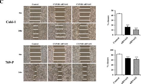Correction Cyp1b1 Promotes Tumorigenesis Via Altered Expression Of