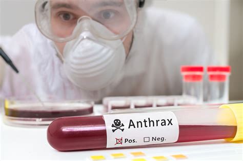Anthrax Infected Russians Escape Siberian Hospital Newsweek