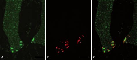 Immunofluorescence Showed Double Labelled Cells For Sox2 Green And