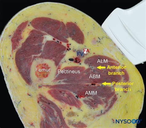 Regional Anesthesia Cross Sectional Anatomy Of Relevance To The