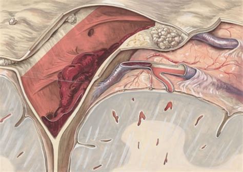 Reticular Tissue A Comprehensive Guide