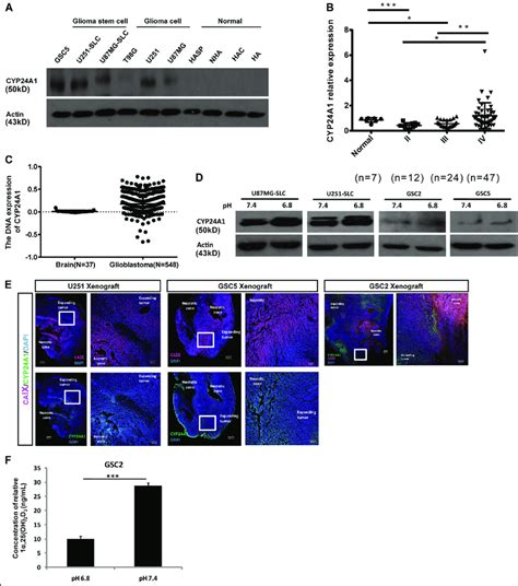 Cyp24a1 Was Highly Expressed In Acidic Microenvironment And High Grade