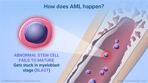 Slide Show Understanding Aml