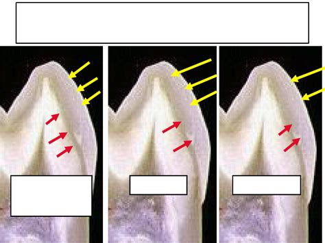 Enamel Pdf Dr Duran Muhadharaty