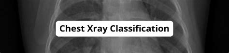 Keremberke Chest Xray Classification Datasets At Hugging Face