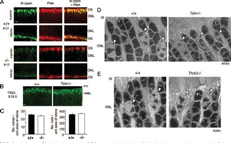 Figure 3 From Retarded Developmental Expression And Patterning Of