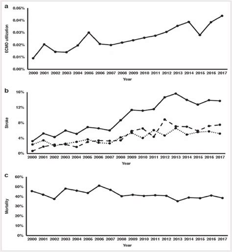 Stroke In Pediatric Patients During Ecmo Findings From A National