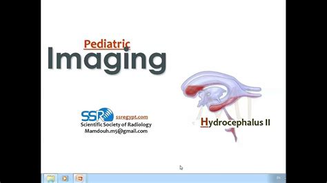 Pediatric Brain Imaging Hydrocephalus Ii Dre Prof Mamdouh Mahfouz