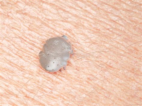 A Scabies Mite Stock Illustration Illustration Of Rendered 127843284
