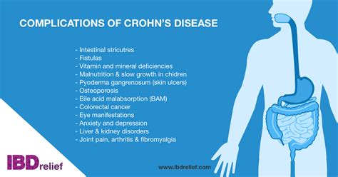 Crohn S Disease Causes Symptoms Diagnosis Treatment O