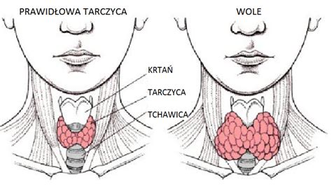 Niedoczynność tarczycy przyczyny objawy leczenie Naturalne