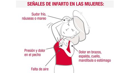 Natura Fósil Asignar Señales De Infarto En Mujeres Punta De Flecha