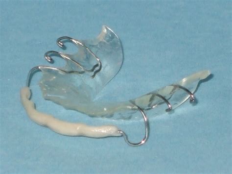 Laboratorio Ortodontico Mrdental Dispositivi Di Contenzione