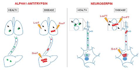 Physiological And Pathological Roles Of Alpha1 Antitrypsin And