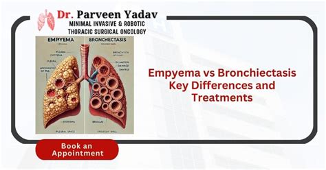 Empyema Vs Bronchiectasis Key Differences And Treatments