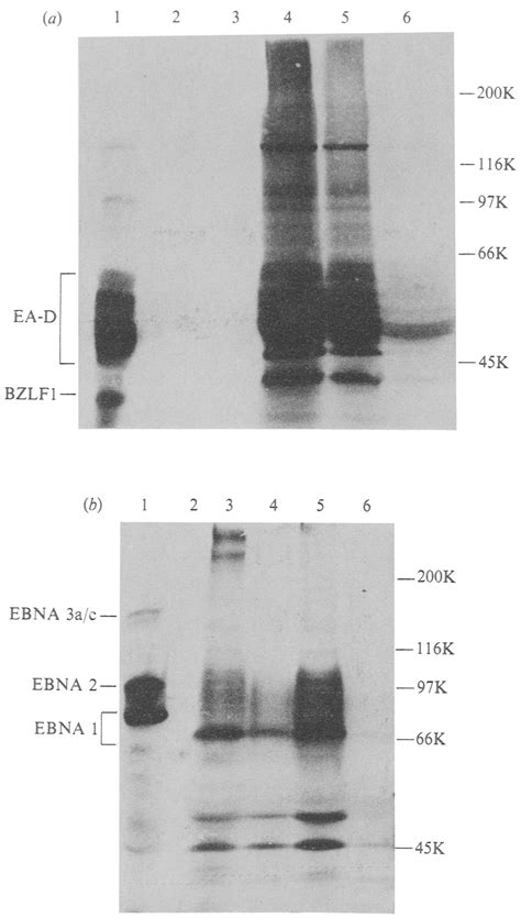 Ebv Gene Expression In Hl A Immunoblot Showing Predominant Download Scientific Diagram