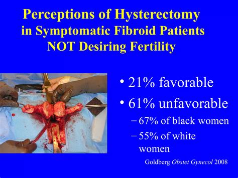 Fibroid Update Lecture 2013 Ppt