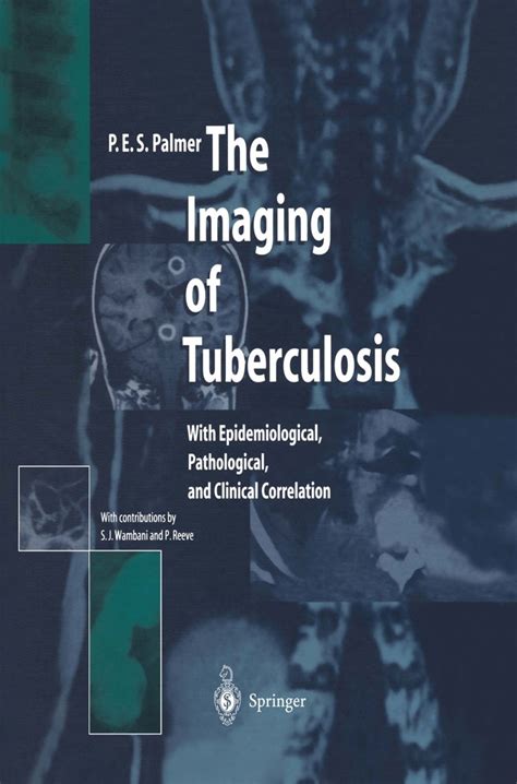 The Imaging Of Tuberculosis With Epidemiological Pathological And