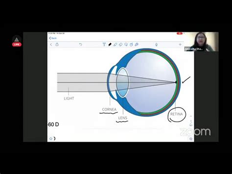Comprehensive Revision Of Ophthalmology Key Concepts And Clinical Insights Galaxy Ai Galaxy Ai