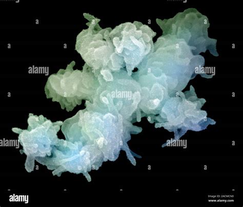 Platelets Coloured Scanning Electron Micrograph Sem Of A Clump Of Activated Platelets From A