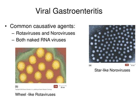 Viral Gastroenteritis