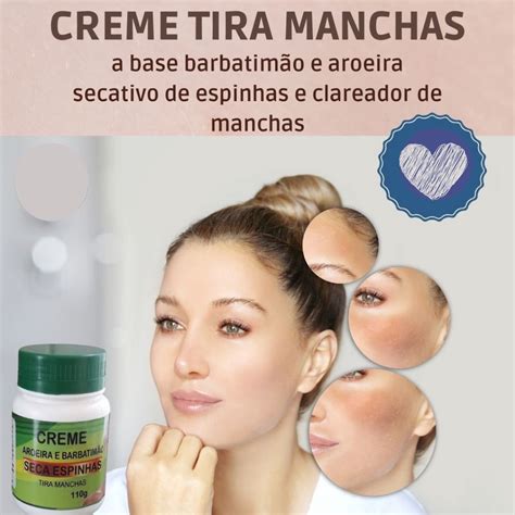 Creme Aroeira Tirar Manchas Do Rosto Creme Clareador E Secativo De Espinhas Espinha