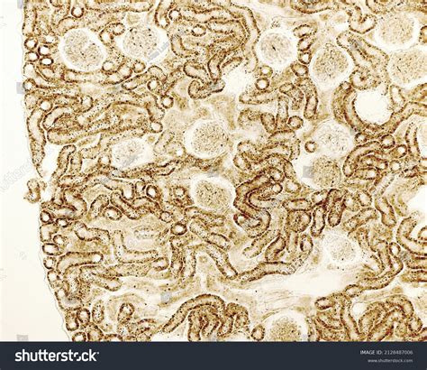 Acid Phosphatase Detection In Lysosom