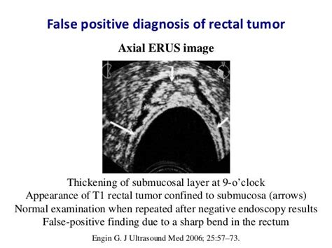 Endorectal Ultrasound In Rectal Diseases