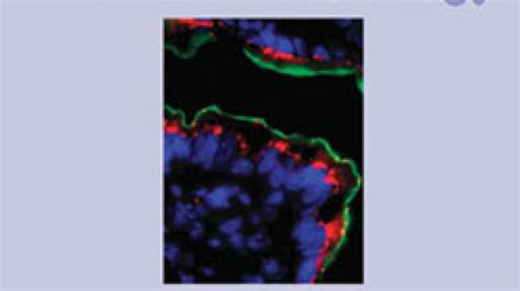 Apc Inactivation Associates With Abnormal Mitosis Completion And