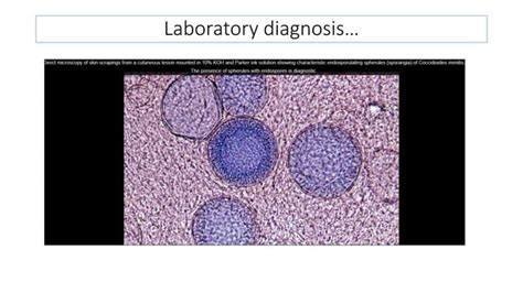 Dimorphic Systemic Mycoses Pptx