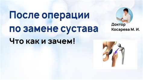 Замена тазобедренного сустава Youtube