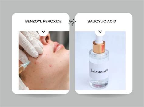 Salicylic Acid Vs Benzoyl Peroxide For Acne Which Is Best