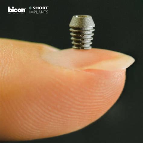 Bicon Institute Uae On Linkedin Bicon Onlybicon Shortimplants