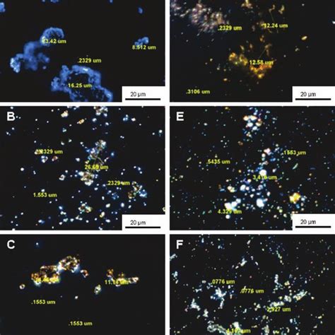 Particle Dispersion In Aqueous Solution Examined With Advanced