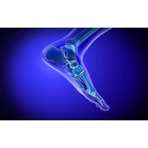 X Ray View Of Human Foot Poster Print
