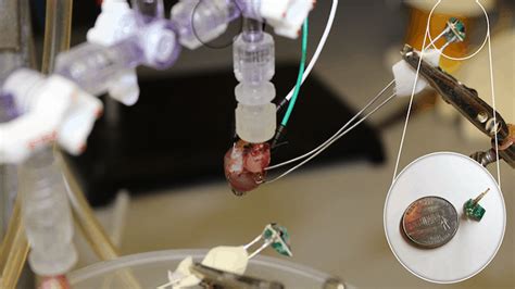 Grant To Develop Wireless Leadless Pacemaker Today S Medical