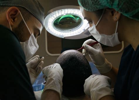 Como escolher o melhor médico para o transplante capilar Dr Marcos