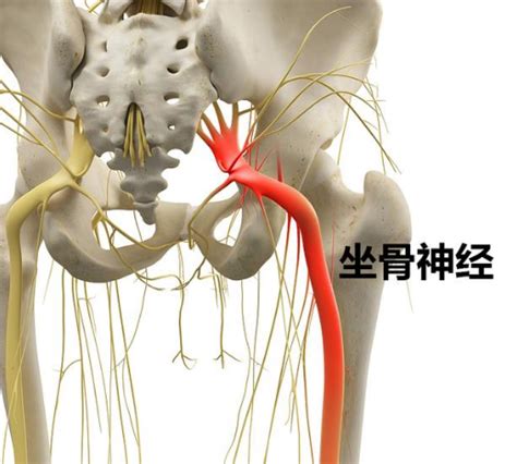 腿疼、腿麻、屁股疼这些症状出现 高度怀疑是“坐骨神经痛”！ 知乎