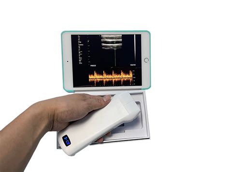 Wireless Linear Array Ultrasound Probe Usb Linear Ultrasound Transducer
