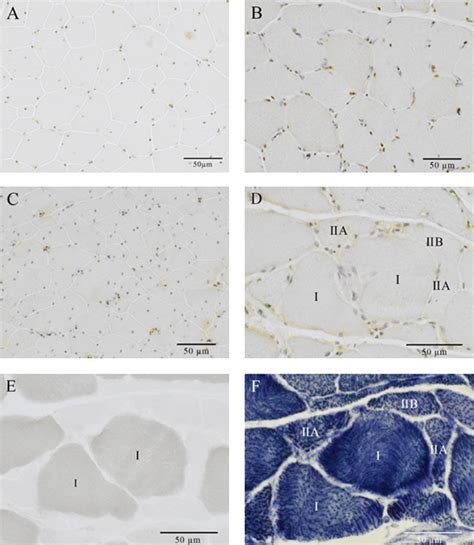 A C Immunohistochemical Localization Of Igf 1 Receptor In Myofibers Download Scientific