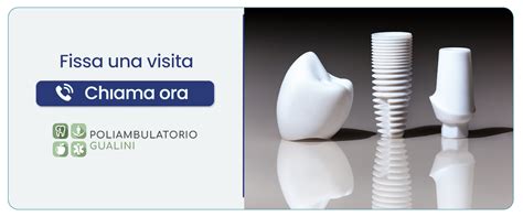 Tipi Di Impianti Dentali