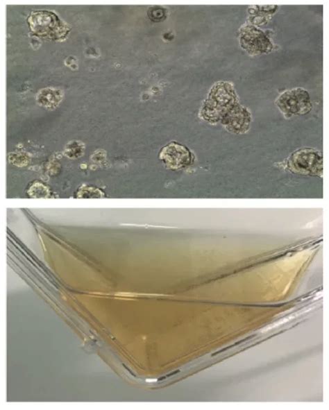 A Suspension Technique For Efficient Large Scale Cancer Organoid