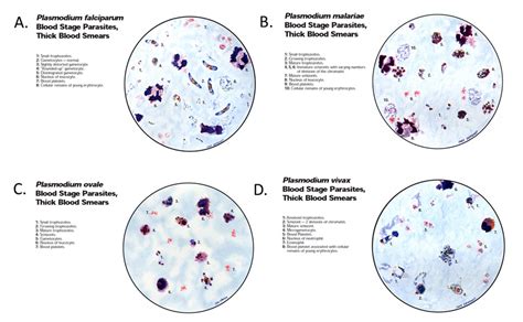 Plasmodium Microscope