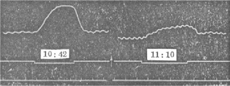Figure 2 From Pathological Physiology And General Pathology Semantic