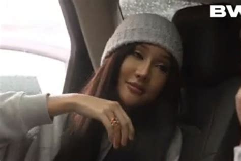 Foto Lucinta Luna Pamer Wajah Baru Usai Operasi Ganti Kepala